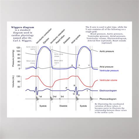 Wiggers Diagram Poster Zazzle