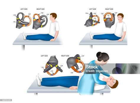 General Dixhallpike Test Stock Illustration Download Image Now