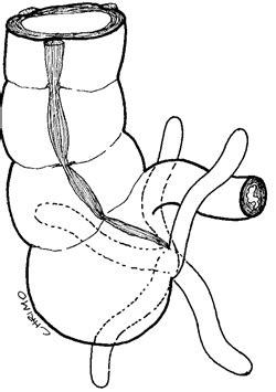 32 The Peritoneum And The Organs Of The Gastrointestinal System