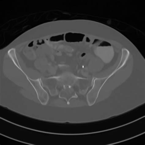 Representation Of The Multi Scale Schemes With Obtained Reconstruction Download Scientific