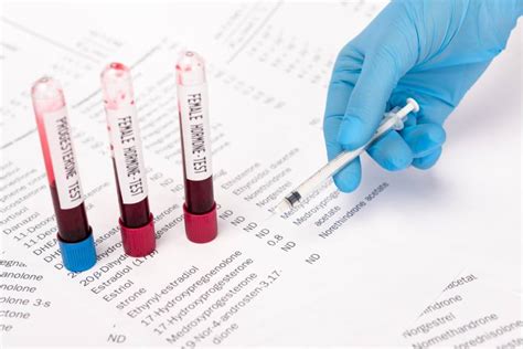 Para Qu Sirven Las Pruebas Hormonales Cl Nica La Virgen De Guadalupe