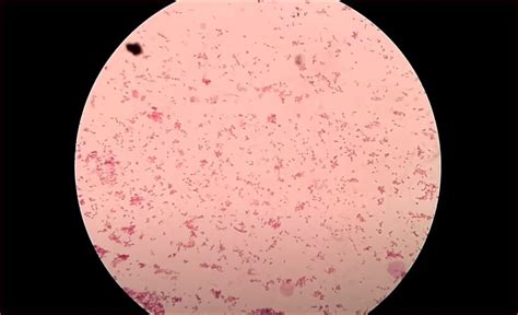 Salmonella Paratyphi Introduction Identification Features Key