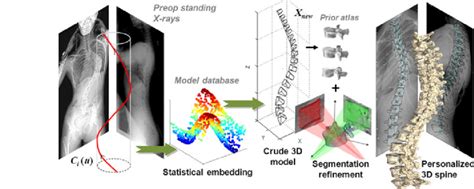 Illustration Of The Personalized 3d Spine Reconstruction From