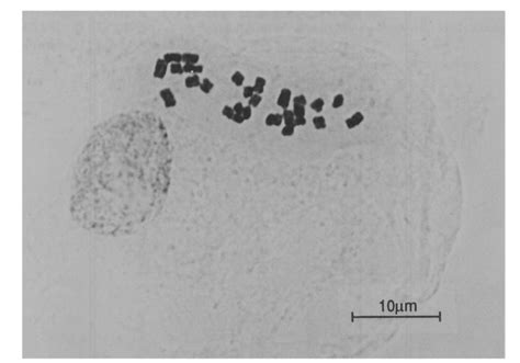 Root Tip Metaphase Scale Bar 10pm Download Scientific Diagram