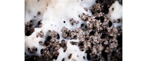 Bone Ingrowth Into The Porous Coated Surface Of An Uncemented Cup Download Scientific Diagram