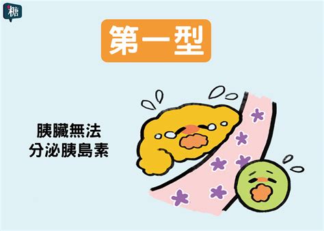 講糖 什麼是第一型和第二型糖尿病