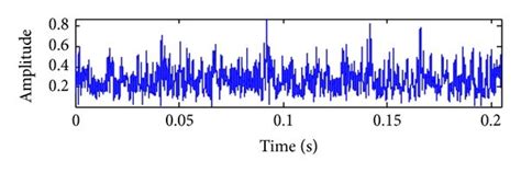 Analyzed Results Of Vibration Signal In Figure 15 A By Emd Based Download Scientific Diagram