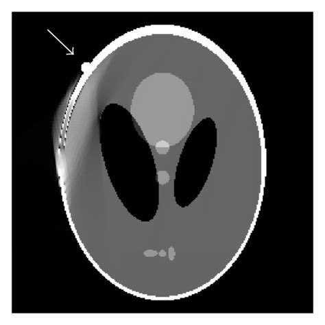 reconstruction results by different initial images a result from download scientific diagram
