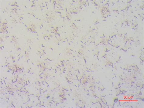 Enterobacter Gram Stain Results