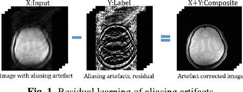 Figure 1 From Deep Residual Learning For Compressed Sensing Mri