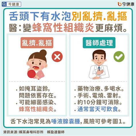 舌頭下有水泡是什麼？是口腔癌嗎？醫：不是，但小心共同風險！ 健康大小事 生活 Nownews今日新聞