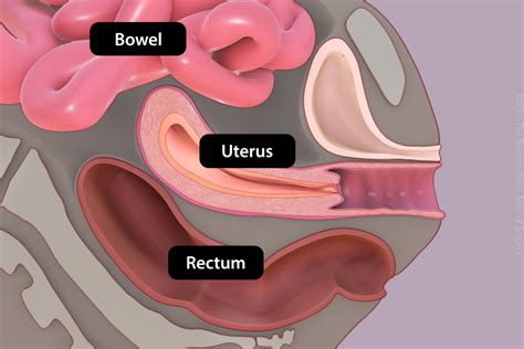 Patient Education Laparotomy Open Surgery The Toronto Video Atlas Of Surgery