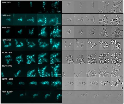 Cell Separation In C Auris Isolates In Microfluidic Growth Chambers Download Scientific