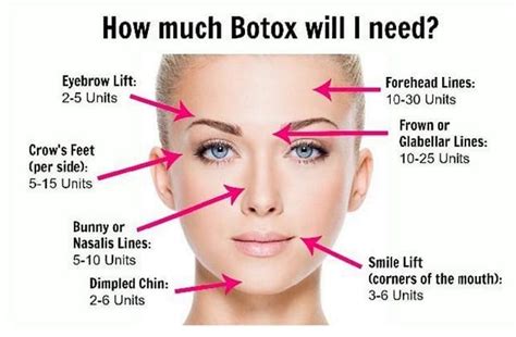 Thinking About Botox How Many Units Of Botox Will You Need And What Is The Cost