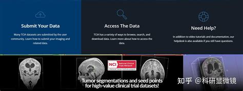 宝藏免费临床数据库 癌症影像档案馆the cancer imaging archive（tcia） 知乎