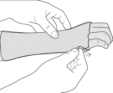 Guide MCP Arthroplasty Splint