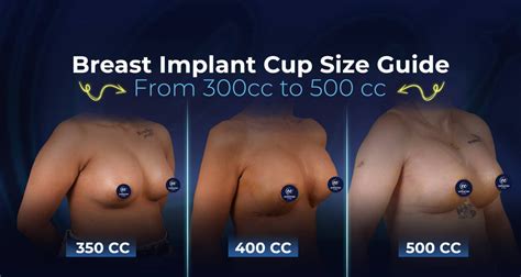 400cc Breast Implants Before And After Estherian Clinic