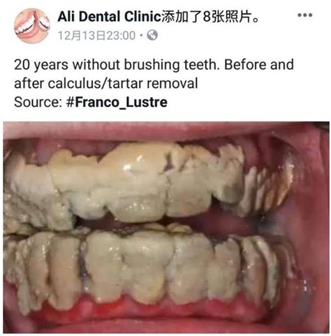 年轻人没有牙齿的图片 年轻人牙齿掉光的图片 没有牙齿的人图片 第7页 大山谷图库