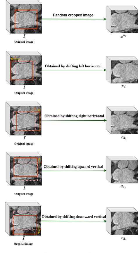 Figure 1 From Leveraging Fixed And Dynamic Pseudo Labels For Semi Supervised Medical Image