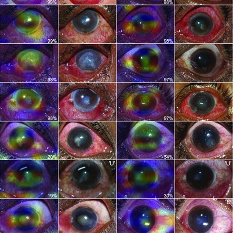 Representative Gradient Class Activation Heatmaps Of The Images On Download Scientific Diagram