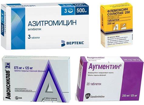 Антибиотики при трахеите - обзор применяемых препаратов