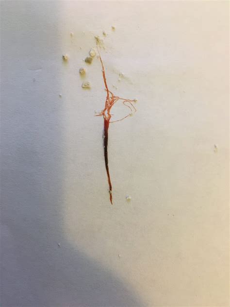 Red Worm Identification Identification Forum Nano Reef Community