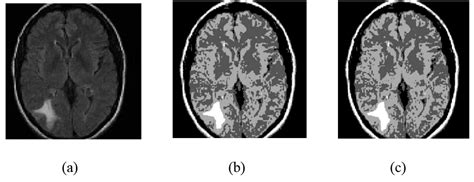 直觉模糊c均值聚类与图像阈值分割 herbert zero的博客 csdn博客 直觉模糊聚类