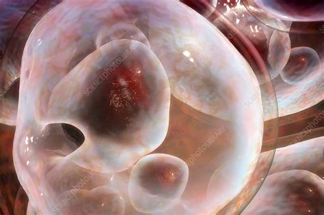 Echinococcus Multilocularis Hydatid Cyst Illustration Stock Image F028 9401 Science Photo