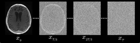 Figure 1 From Super Resolution Diffusion Model For Accelerated Mri Reconstruction Semantic Scholar