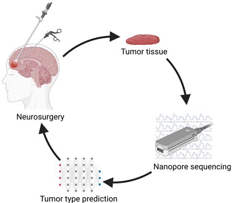Neural Networks In Neurosurgery The Role Of Ai As A Surgical Assistant Oncobites