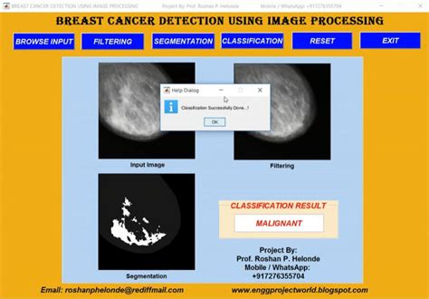 Detection Classification Of Breast Cancer Using Image Processing Matlab Project With Source