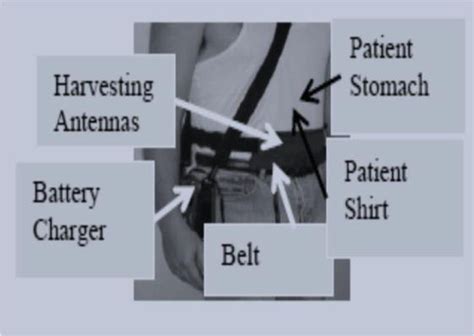 Green Wearable Sensors For Medical Energy Harvesting Communication And IoT Systems IntechOpen