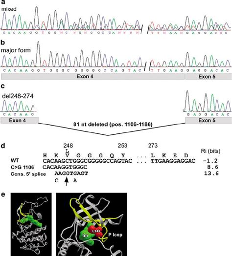 Abl Kinase Domain Sequence Abnormalities Identified In Association With Download Scientific