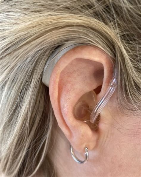 Phonak Hearing Aids Reviews Prices Models