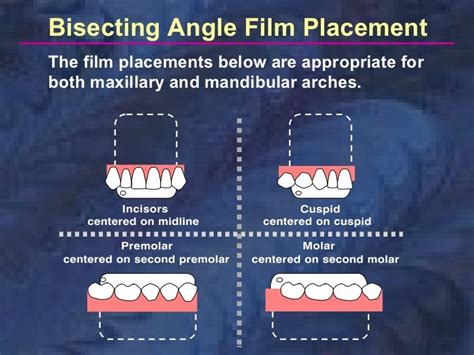 Radio Graphic Techniques Bisecting And Occlusal