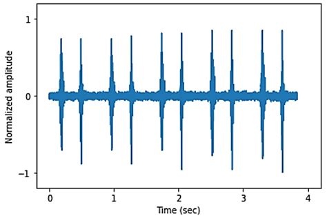A Normal Heart Sound Signal With 8012 Hz Sampling Frequency And 30745