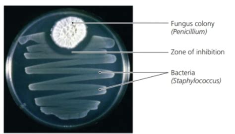 Microbiology Lab 1 Quiz Flashcards Quizlet