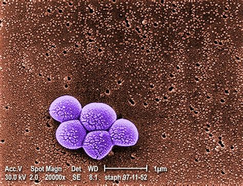 Free Picture Grouping Methicillin Resistant Staphylococcus Aureus Mrsa Bacteria