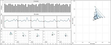A Heart Rate Tachogram B R R Tachogram And C D Poincaré Plot Download Scientific Diagram