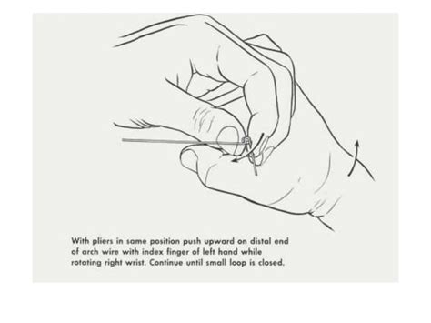 Loops In Orthodontics T Loop Bull Loop Vertical Loop Mushroom Loop Stop