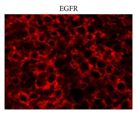 Double Immunofluorescence Staining For Egfr A D G And J Red Stain