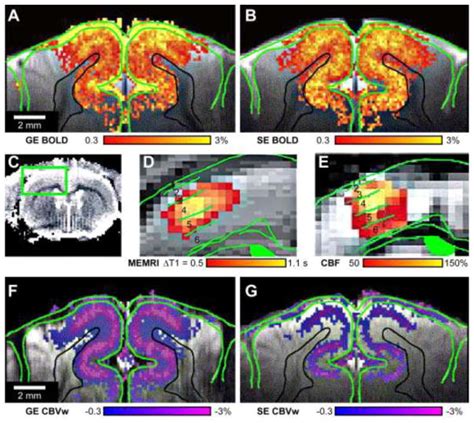 Foundations Of Layer Specific Fmri And Investigations Of Neurophysiological Activity In The