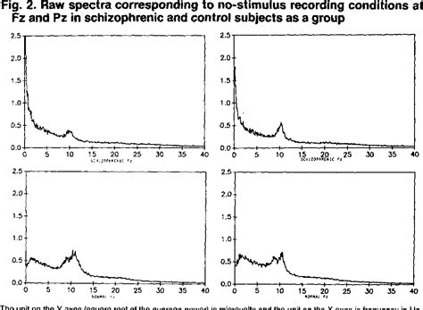 Figure 2 From Eeg Alpha Photic Driving Abnormalities In Chronic