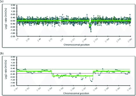 Array Cgh Results Reveal A 37 Mb Deletion In 2q233 Q241 A Download Scientific Diagram