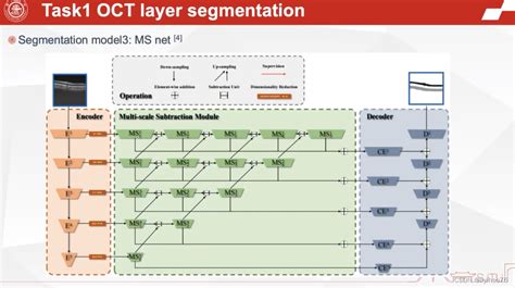 百度goals比赛总结miccai2022 Challenge Goals Csdn博客