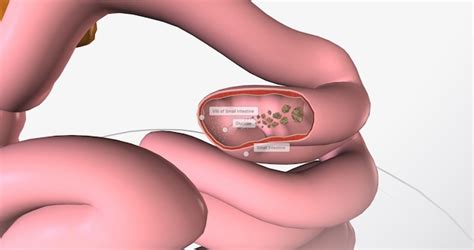 20 Galactose Pictures