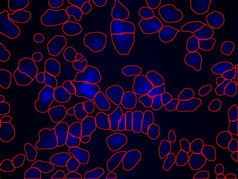 Cellseg Roboflow Universe