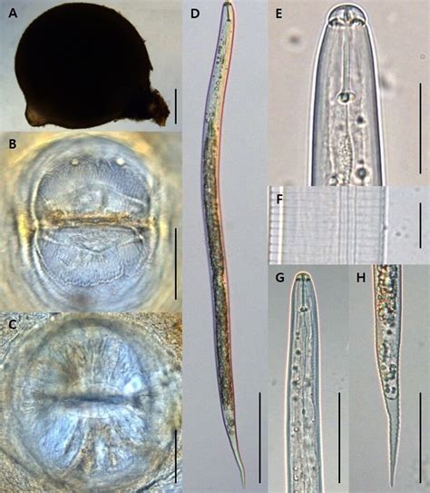 The Morphological Characterization Of Cyst Vulval Cone And Download Scientific Diagram