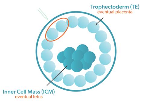 Trophectoderm Embryo Biopsy Genetic Testing Of Embryo San Antonio
