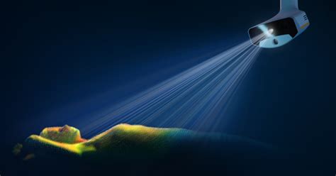 Brainlab Se Added An Event